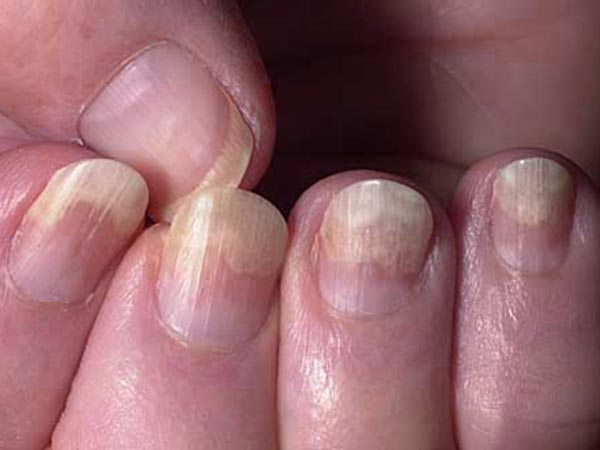 Things You Might Not Know About Your Nails - Boldsky.com