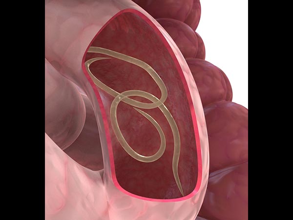 How To Know Parasites Are Inside The Body - Boldsky.com