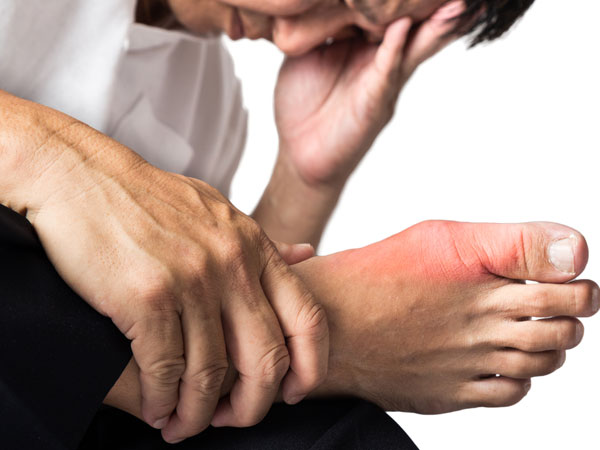 7 Juices To Remove Uric Acid From Body And Relieve Gout Pain - Boldsky.com