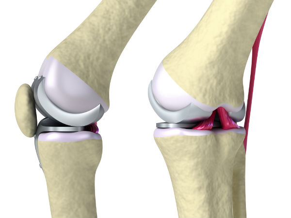 Foods That Increase Bone Strength - Boldsky.com