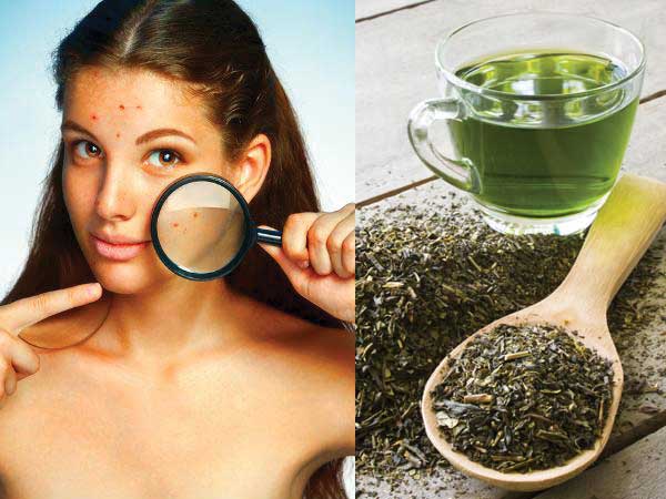 7 Easy Green Tea Remedies For Acne - Boldsky.com