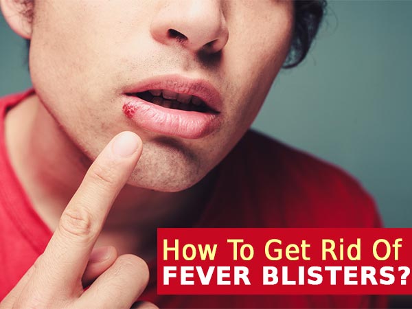 How To Heal Fever Blisters In 24 Hours Boldsky