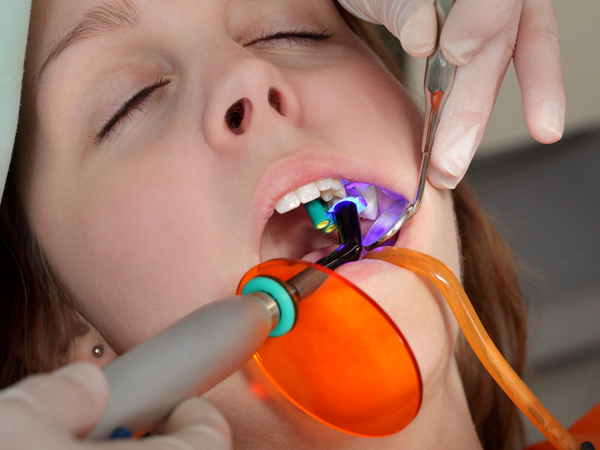 Laser Dentistry: The New Tool In Dental Care - Boldsky.com