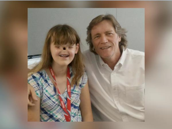 Shocking Special Kids Who Exist - Boldsky.com