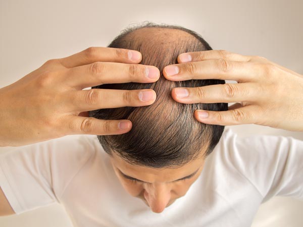 Reasons Why Your Hair Is Not Growing - Boldsky.com