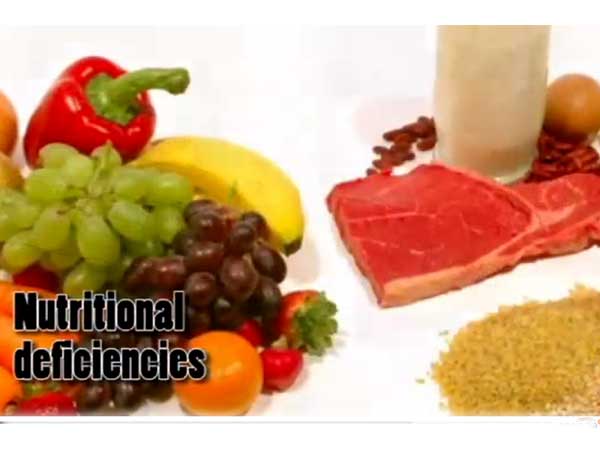 Extreme Dieting Might Lead To These Health Problems - Boldsky.com