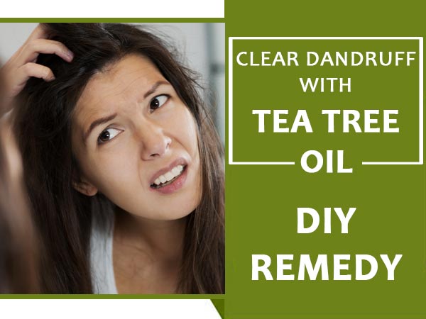 5 DIY Tea Tree Oil Remedies For 99% Dandruff Clearance! - Boldsky.com