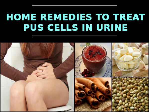 Effective Home Remedies To Get Rid Of Pus Cells In Urine Boldsky effective-home-remedies-to-get-rid-of-pus-cells-in-urine-boldsky