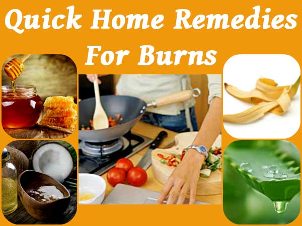 Burnt Your Hand While Cooking? These Home Remedies Give You Instant ...