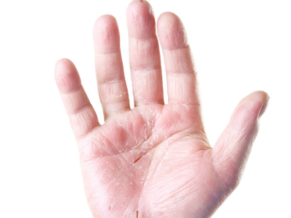 The Role Of Turmeric in Prevention & Cure - Boldsky.com