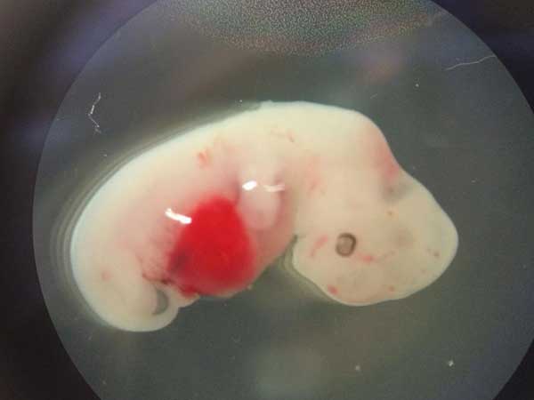 Have You Heard About The Human–Pig Hybrid? - Boldsky.com