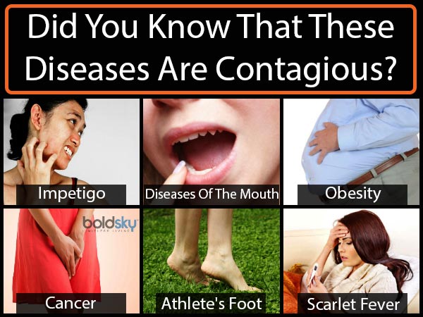Did You Know That These Diseases Are Contagious? - Boldsky.com