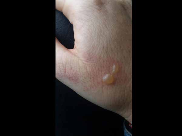 Her Earphones Exploded On A Flight! - Boldsky.com