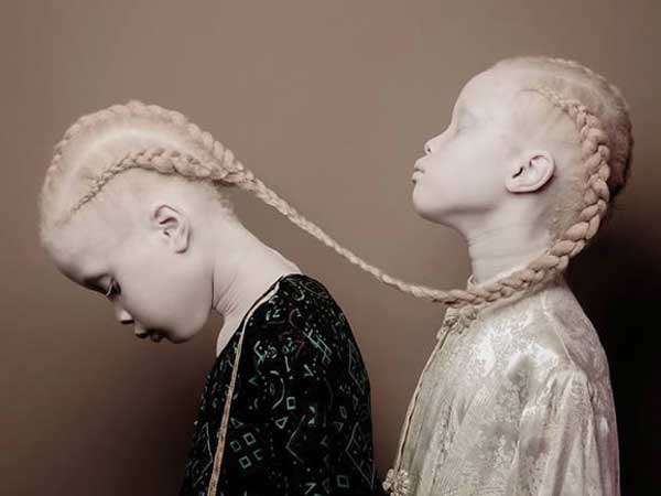 Double Treat: These Remarkable Twins Sure Rocked The World! - Boldsky.com