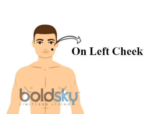 What Exactly Do The Moles On Your Body Reveal - Boldsky.com
