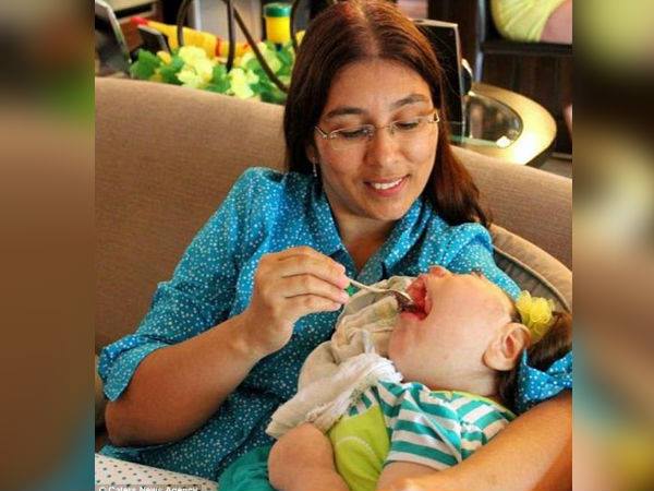 She Did Not Have A Face When She Was Born, Yet She Survived - Boldsky.com