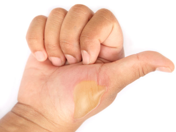 Surprising Skin Care Benefits Of Ginger - Boldsky.com