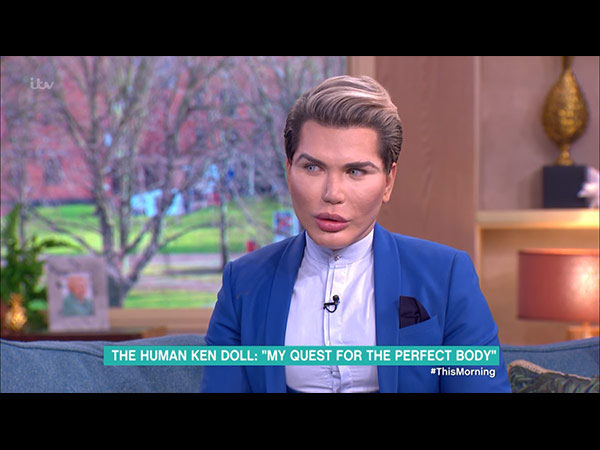 Human Ken Doll Shared His Pictures Before 58 Surgeries - Boldsky.com