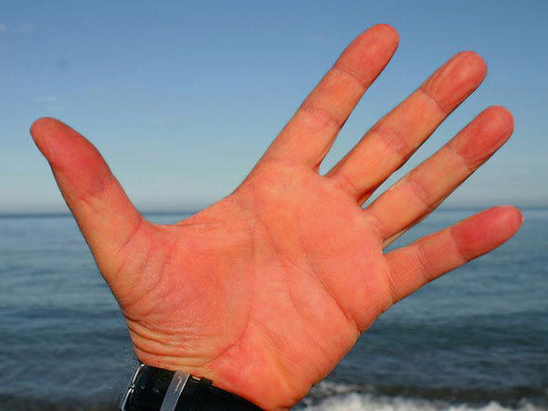 Colour Of Your Palm Reveals This Secret About You - Boldsky.com