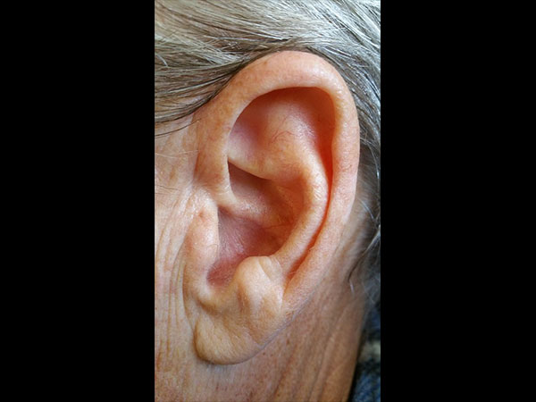 When Doctors Removed 30 Maggots From A Woman's Ear! - Boldsky.com