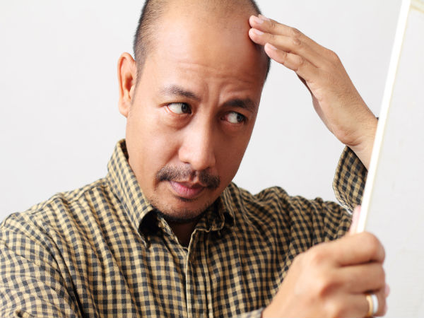 These Remedies Will Help You To Regrow Hair On Your Bald Forehead ...