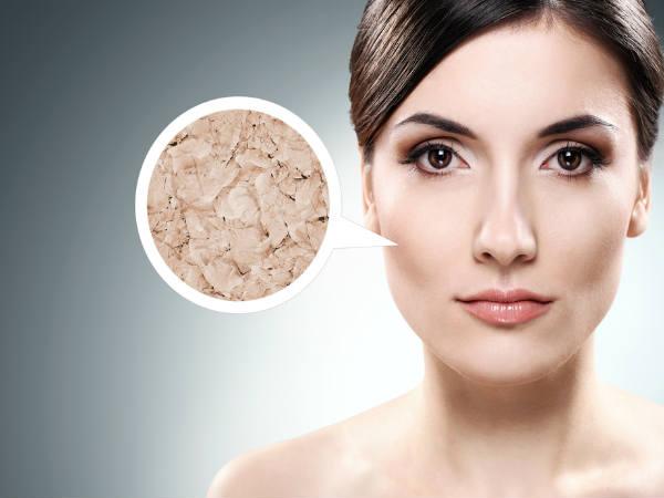How To Treat Dry Skin On Cheeks? - Boldsky.com