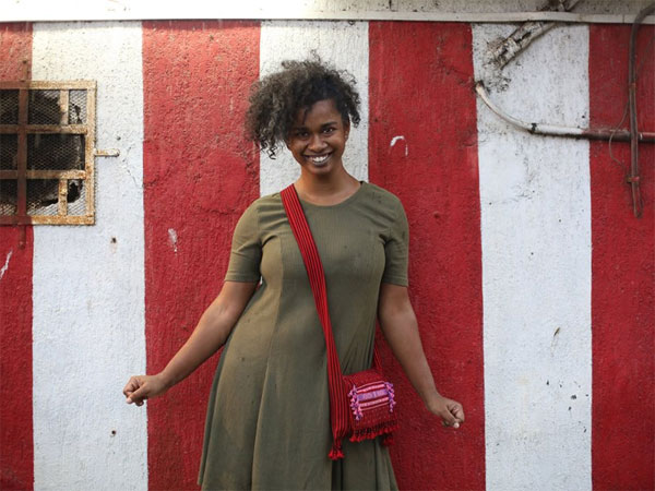 She Was Shunned By People For Her Colour And Hair! - Boldsky.com