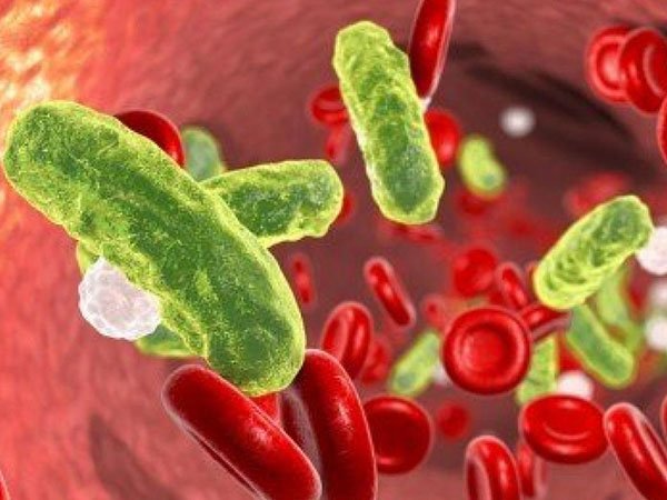 World Sepsis Day 2019: Sepsis: Causes, Symptoms, Effects, Diagnosis And ...