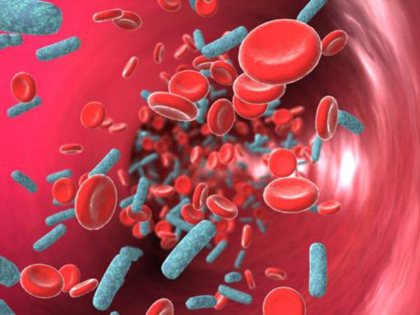 World Sepsis Day 2019: Sepsis: Causes, Symptoms, Effects, Diagnosis And ...