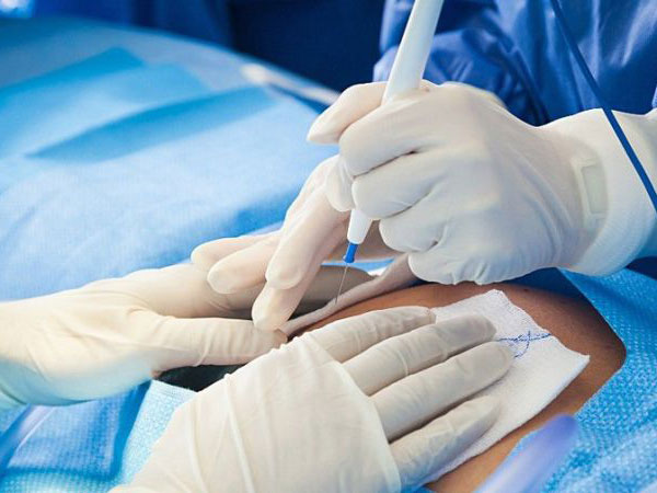 Why Is Bloodless Open Heart Surgery Simple And Safe - Boldsky.com