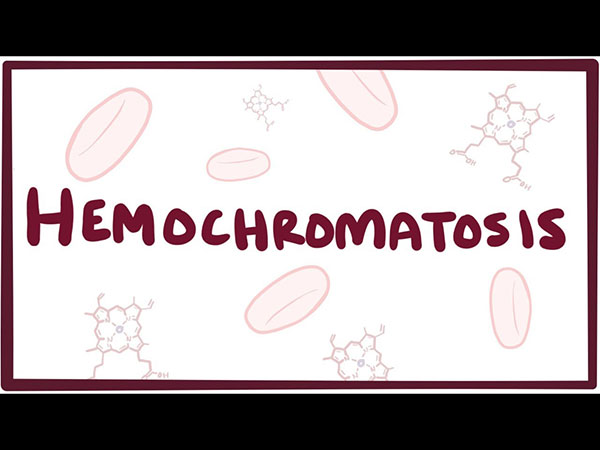 Haemochromatosis (Iron Overload): Types, Symptoms, Causes, Diagnosis ...