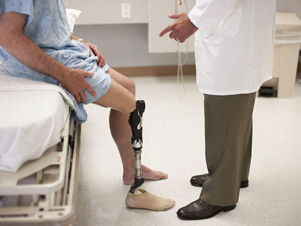 Limb Amputation: Reasons, Procedure And Recovery - Boldsky.com