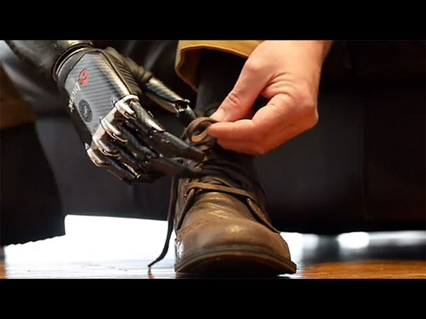 Everything You Need To Know About Bionic Limbs - Boldsky.com