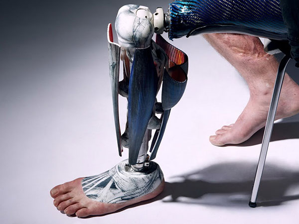 Everything You Need To Know About Bionic Limbs - Boldsky.com