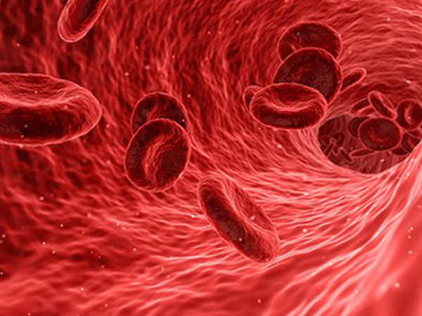 Methemoglobinemia: Symptoms, Causes, Diagnosis And Treatment - Boldsky.com