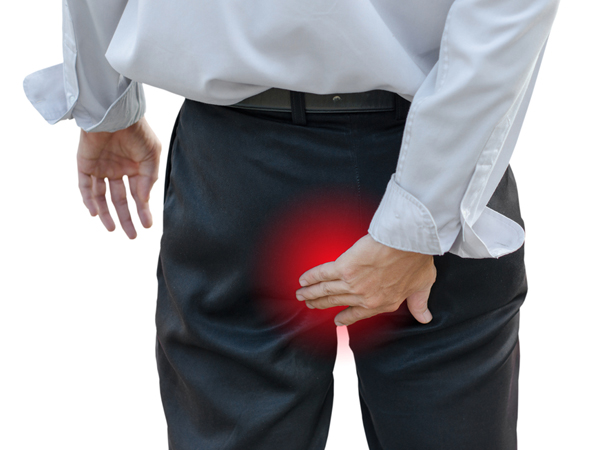 Haemorrhoids (Piles): Types, Causes, Symptoms And Treatment - Boldsky.com