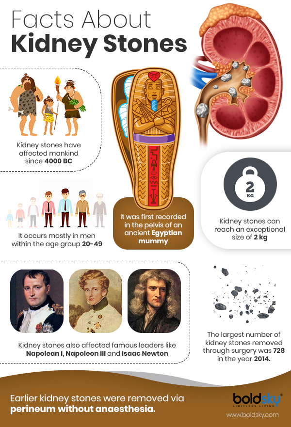 Kidney Stones Symptoms Causes Diagnosis Treatment And Prevention Kidney Stones Symptoms Causes Diagnosis Treatment And Prevention