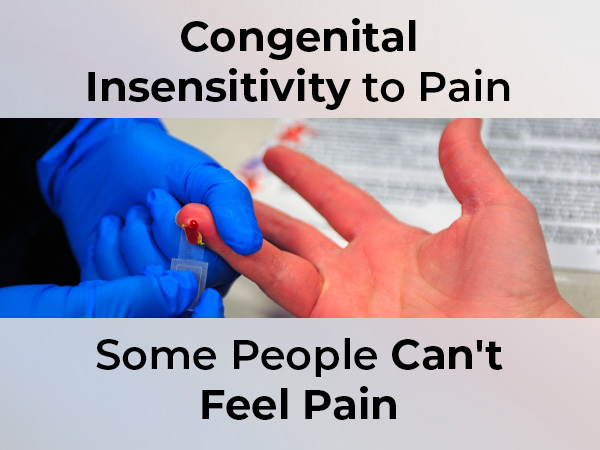 Congenital Insensitivity To Pain (CIP): Causes, Symptoms, Complications ...