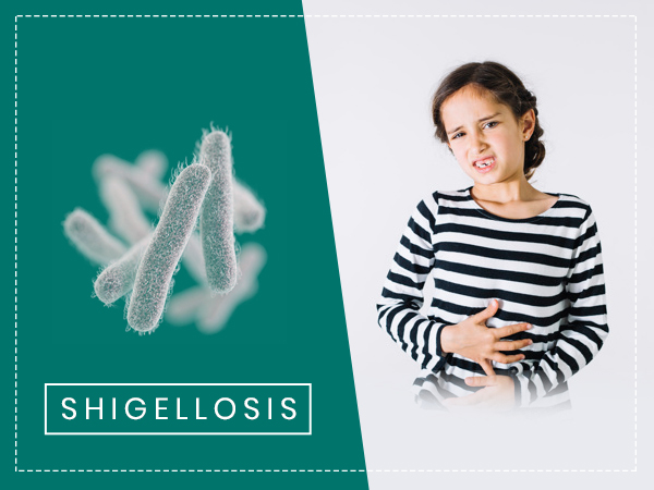Shigella Infection: Symptoms, Causes, Complications, Diagnosis And ...