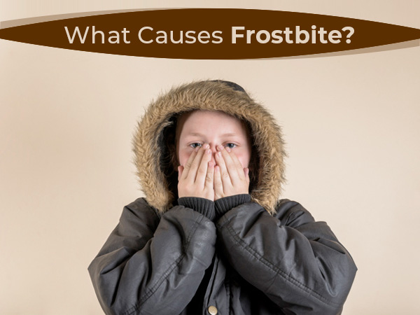Frostbite: Causes, Symptoms, Stages, Risk Factors, Diagnosis ...