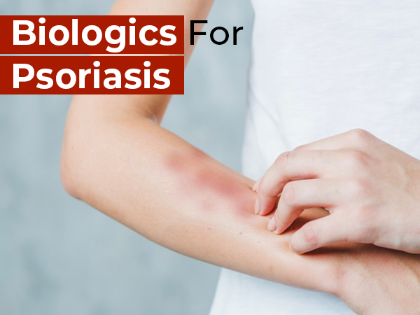 Biologics: What Are They & How They Help Treat Psoriasis - Boldsky.com