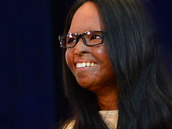 Laxmi Agarwal: Know About The Acid Attack Survivor Deepika Padukone ...