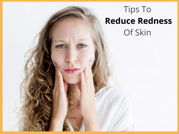 How To Reduce Redness Of Skin During Winters - Boldsky.com