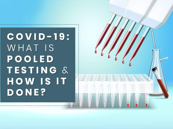 COVID-19: What Is Pooled Testing And How It Works In India? - Boldsky.com