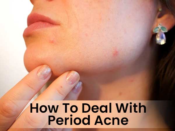 How To Deal With Period Acne: An Exhaustive List Of Solutions - Boldsky.com