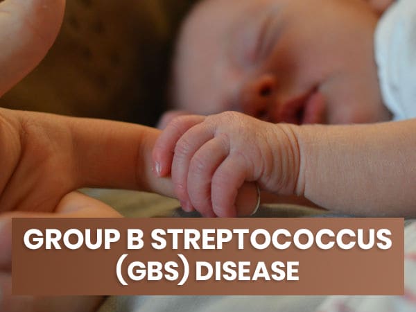 Group B Streptococcus (GBS) Disease: Causes, Symptoms, Risk Factors ...