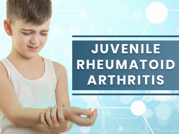 Juvenile Rheumatoid (Idiopathic) Arthritis: Causes, Symptoms, Diagnosis ...
