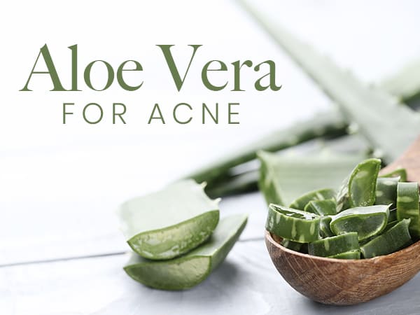 Aloe Vera For Acne: 7 Homemade Remedies To Treat The Issue - Boldsky.com