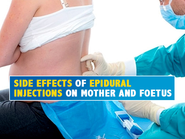 Pregnancy And Birth: Side Effects of Epidural Injections On Mother And ...