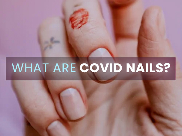 COVID Nails: Is It A Serious Sign Related To COVID-19? - Boldsky.com